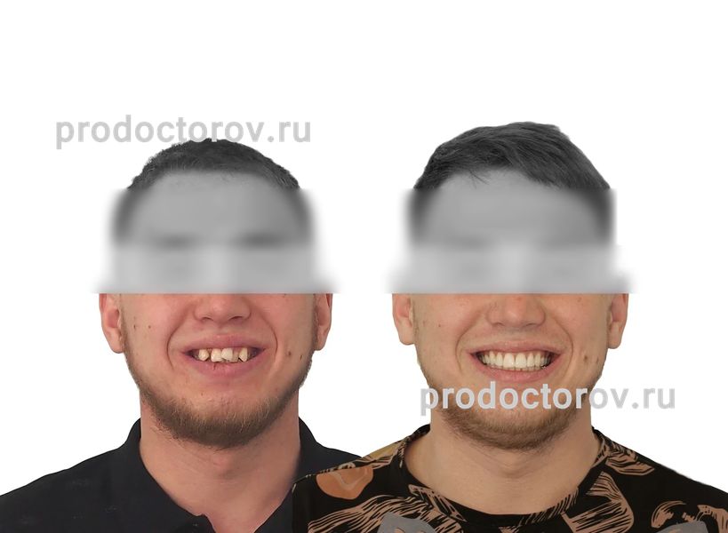 Богданов Руслан Инсурович, стоматолог-ортодонт - 3 отзыва | Оренбург ...