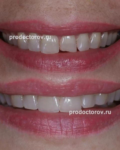 Нефедова Евгения Сергеевна, стоматолог - 64 отзыва | Ростов-на-Дону ...