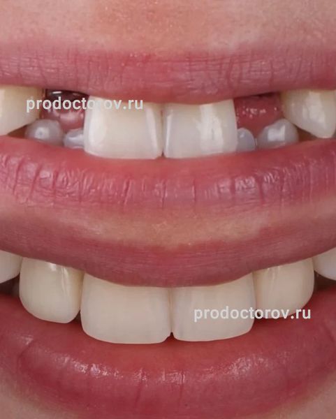 Нефедова Евгения Сергеевна, стоматолог - 64 отзыва | Ростов-на-Дону ...